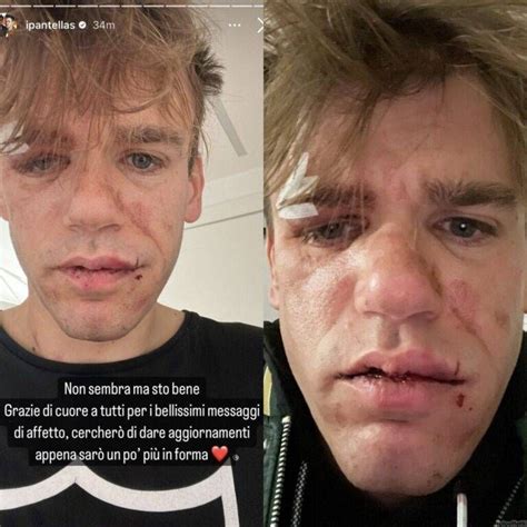 Jacopo Malnati Aggredito A Varese Lo Youtuber De Ipantellas Volevano