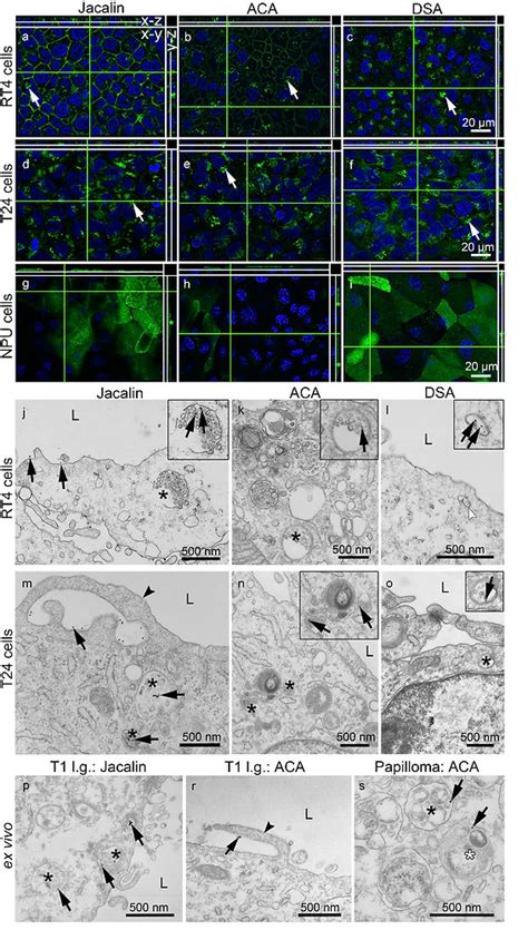 Lectin Conjugates Targeting Cancerous Urothelial Cells For Improved