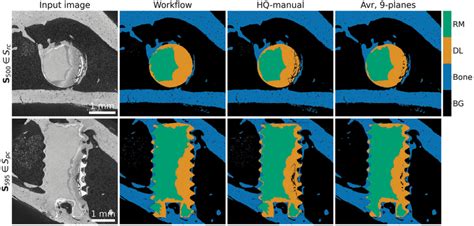 Comparison Between Different Types Of Segmentation Results—high Quality Download Scientific
