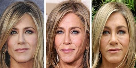 Jennifer Aniston Chirurgie Esthétique Avant Après Et Tous Les
