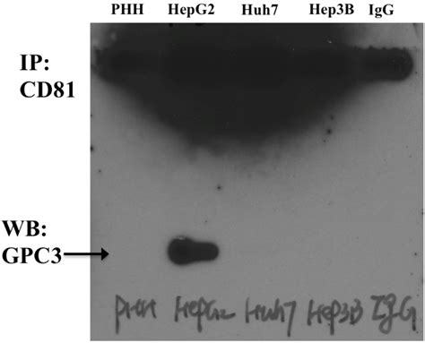 Glypican 3 Gpc3 ‐cd81 Axis Regulates Spleen Tyrosine Kinase Syk ‐ezrin Mediated Hippo Pathway