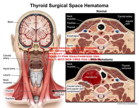 Medical Exhibits Demonstrative Aids Illustrations And Models