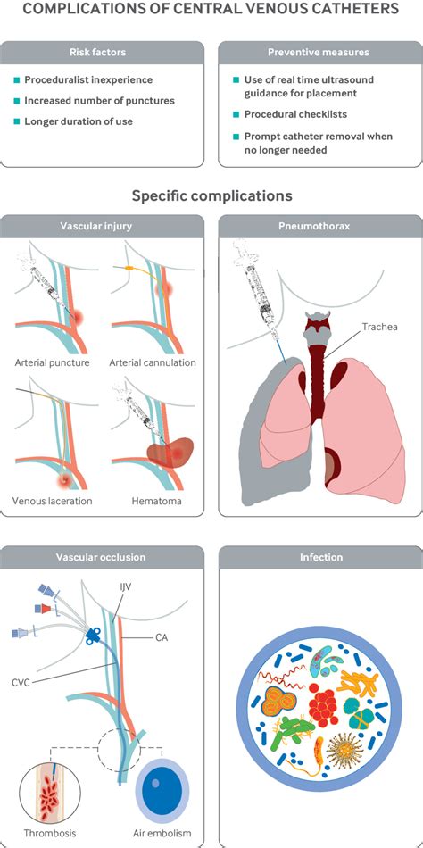 Device Associated Complications In The Intensive Care Unit The Bmj