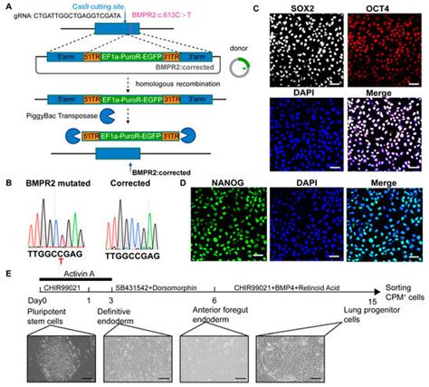 Role Of Bmpr2 Mutation In Lung Organoid Differentiation