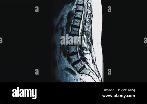 Voluminous Color Mri Of The Female Pelvic Organs Abdominal Cavity Gastrointestinal Tract And