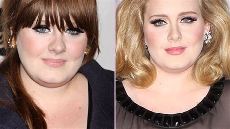 Adele Nose Job — Plastic Surgeons Confirm Adele Plastic Surgery Rumors Hollywood Life