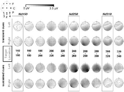 Scalp Topography Of The Difference Waves Between 140 And 340 Ms