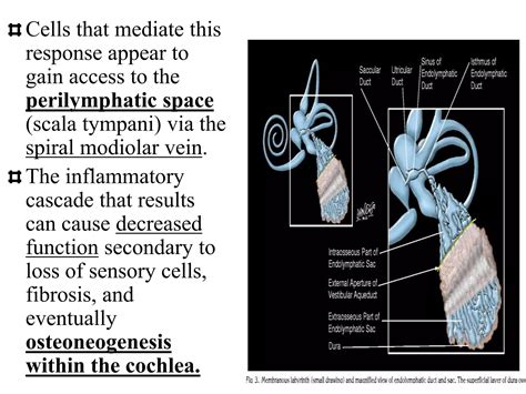 Autoimmune Inner Ear Diseaseaied Pptx
