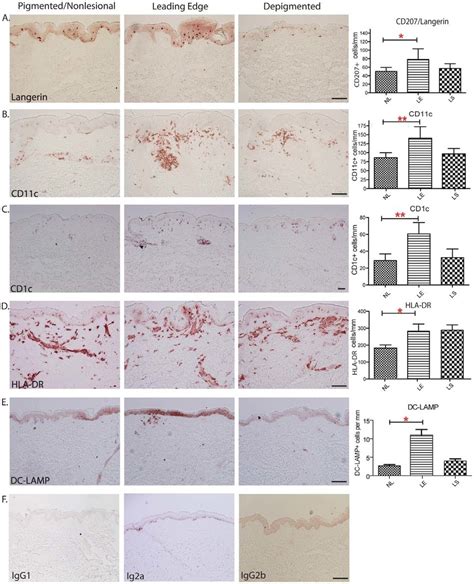 Characterization Of Langerhans Cells Dermal Dendritic Cells