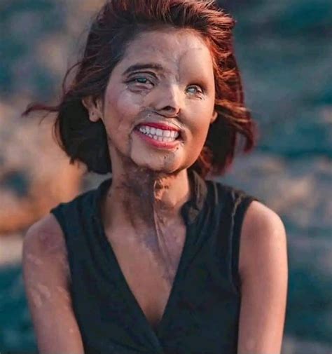 Some - Anmol Rodriguez: A Survivor’s Story of Strength and Inspiration She was supposed to die ...