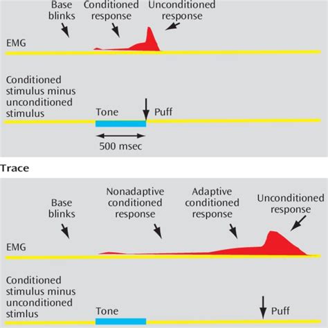 Schematic Depiction Of Delay And Trace Eyeblink Conditioning A