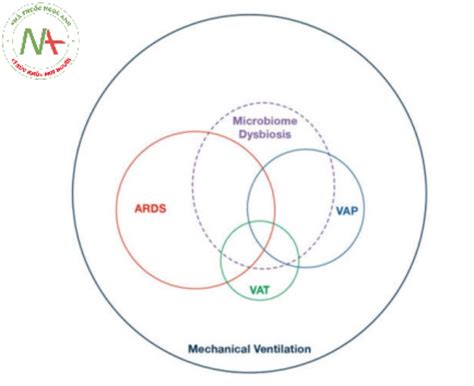 Nhiễm Trùng Phổi Biến Chứng Từ Ards