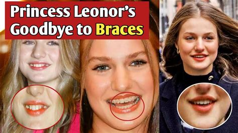 Princess Leonor Goodbye To Teeth Braces And Surprise With New Beautiful