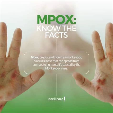 Intellicare Hmophilippines Hmo Marvin Palang