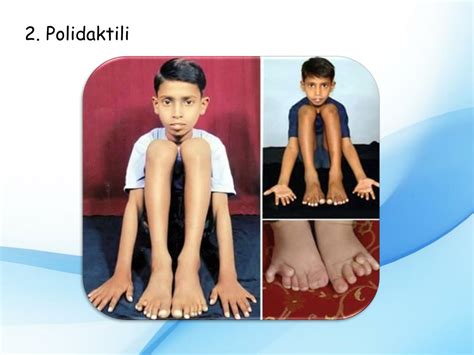 Ppt Hereditas Powerpoint Presentation Free Download Id2025486