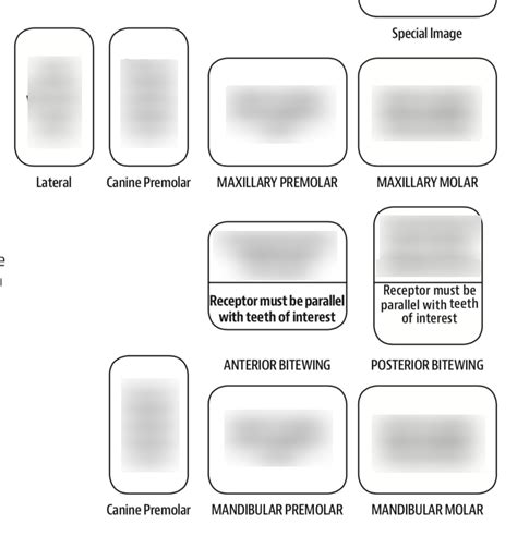 Radiographic Errors Landmark Sheet Intraoral Technique Diagram Quizlet