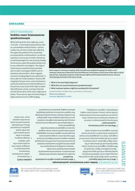 Pdf Sudden Onset Homonymous Quadrantanopia