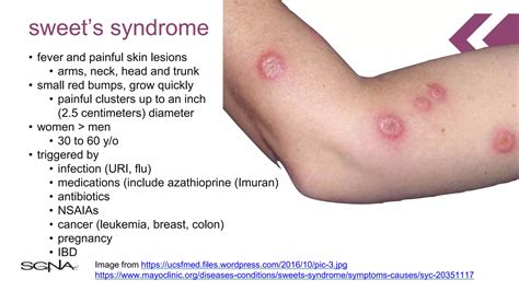 Know Gi Inside And Out Recognizing Skin Lesions Of Gi Disorders Pptx