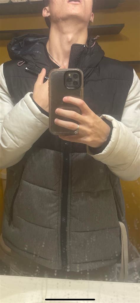 Does This Lymph Node Look Concerning Its Been On The Larger Side For A Couple Of Years R