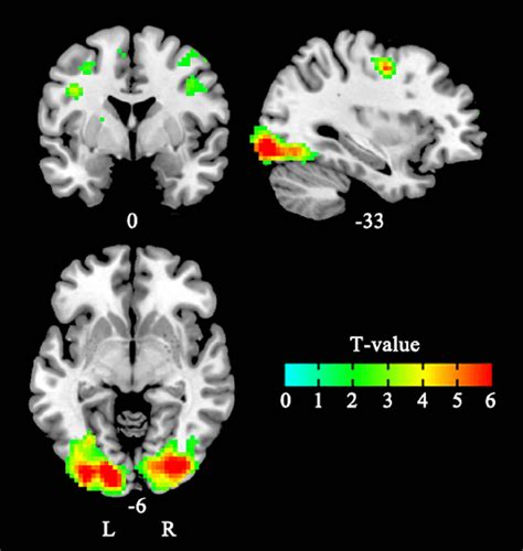 Maps Showing Brain Areas In Which Activity Was Greater For