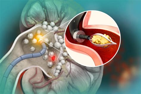 无锡肾结石医院全新排名榜单？ 无锡嘉仕恒信医院 39就医助手