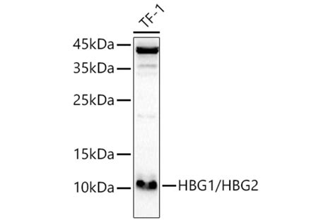 Anti Fetal Hemoglobin Antibody A307353