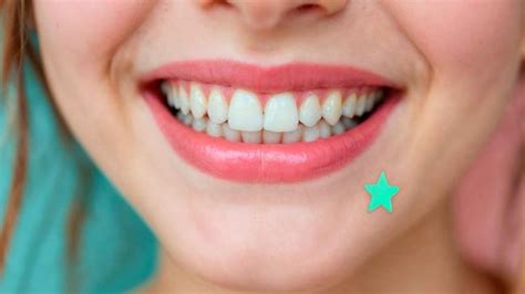 Pimple Patch Jadi Tren Benarkah Bisa Bantu Atasi Jerawat Ini