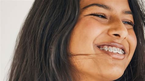 Overbite Vs Underbite Plus Ultra Plus Ultra