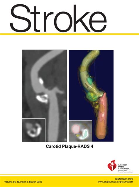 Optimal Duration Of Dual Antiplatelet Therapy After Carotid Artery Stenting A Nationwide Cohort