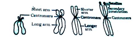 A Acrocentric Chromosomes B Telocentric Chromosomes C Metacentric Ch