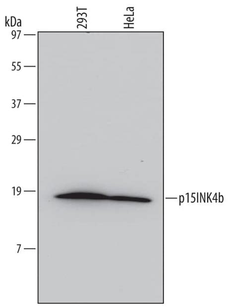 Human P15ink4b Cdkn2b Antibody Mab6798 Randd Systems