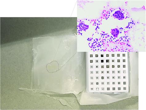 Detection Of Cells Dissociated From Cell Pellet Placed In The Cassette