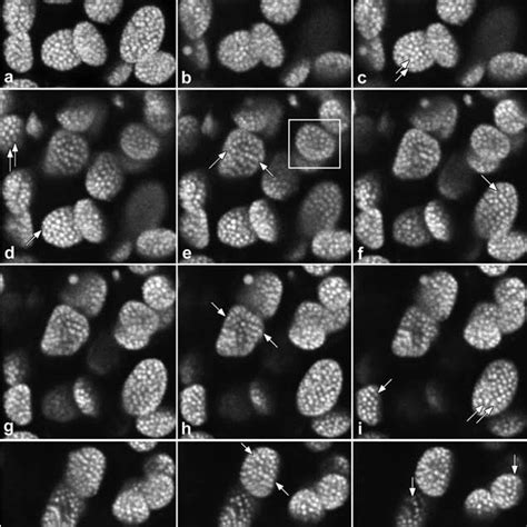 Chloroplasts In A Living Mesophyll Cell Of Spinach Observed By Phase