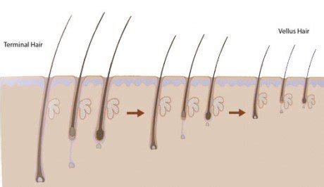 Terminal Hair Vs Vellus Hair