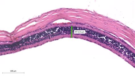 Video Preparation And Analysis Of Histological Slides Of Rat And Mouse Eyeballs To Evaluate The