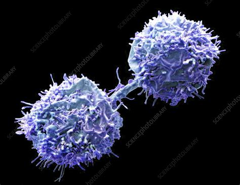Dividing Lymphoma Cancer Cells Sem Stock Image C0603096 Science