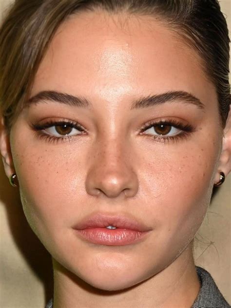 Britney Spears Acne Scars