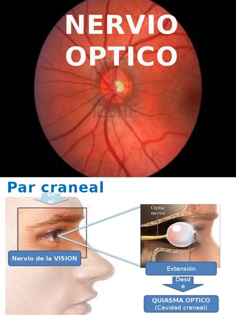 Anatomía Del Nervio Óptico Pdf Cabeza Y Cuello Humanos Anatomía