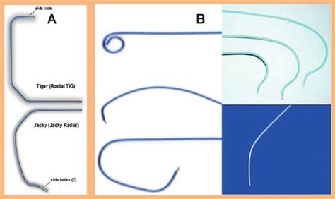 Patient With Myocardial Staining Due To Inadvertent Left Ventricular