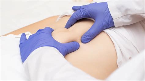 Do All Hernias Require Surgery Dr Michael Chu