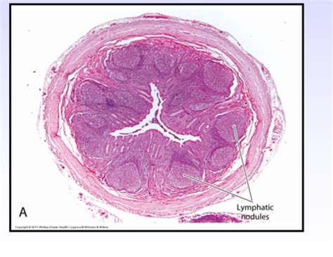 Lymphoid Organs 6 Flashcards Quizlet