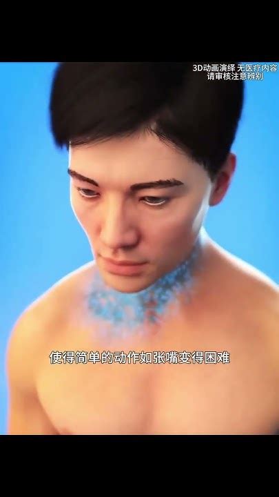 当你的脚踩到生锈的钉子后会发生什么 看完你就明白了 奇异世界 驚人 惊人 科普知识 科普 科普一下 科普長知識 Youtube