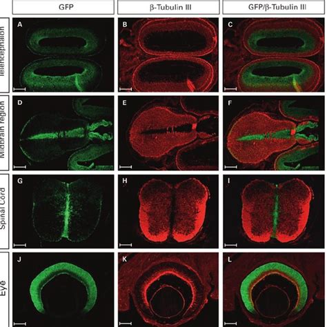 Egfp Expression Is Mutually Exclusive Of Postmitotic Markers A I Download Scientific Diagram