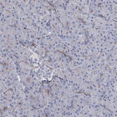 Anti Synaptopodin Synpo Mouse Monoclonal G1d4 Lyophilized Purified 50 µg 61094