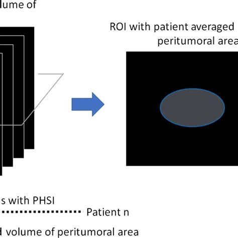 Methods To Complement Missing Values Of The Texture Features Of The