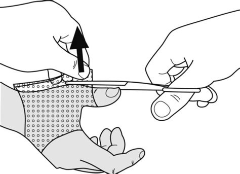 Guide Thumb Stabilization Splint Orfit Industries Hand Therapy