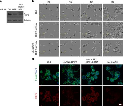 Rescue Of Hsf2 Expression Reverses The Invasive Phenotype Of Prca
