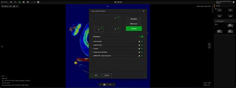 Web Viewer Dicom Systems