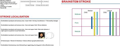 Integrated Neurology 7 Diagram Quizlet
