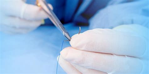 Surgical Instruments Suture Materials And Closure Choices Surgipro